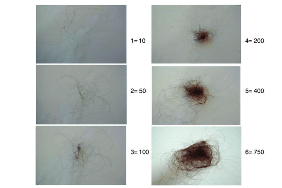 Caderea Parului - Ghid Complet de Tratament si Preventie