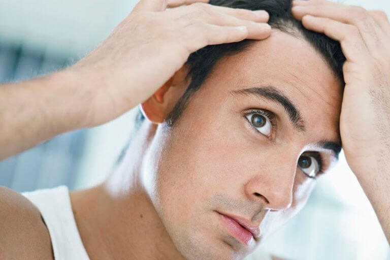 Caderea Parului - Ghid Complet de Tratament si Preventie